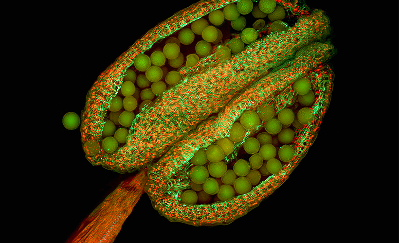 electron-microscopy – Turku Bioimaging