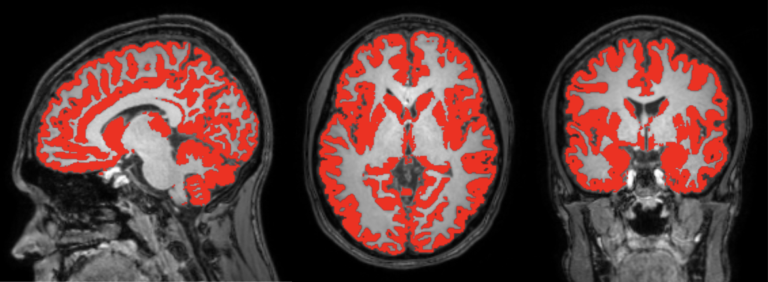 Turku Bioimaging – More than you can imagine